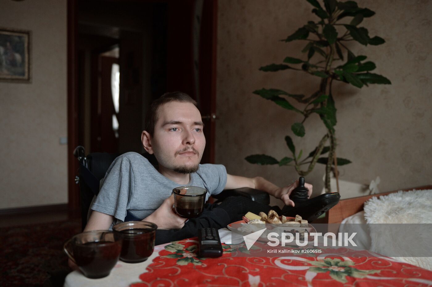 Russian Valery Spiridonov agrees to world's first head transplant | Sputnik Mediabank